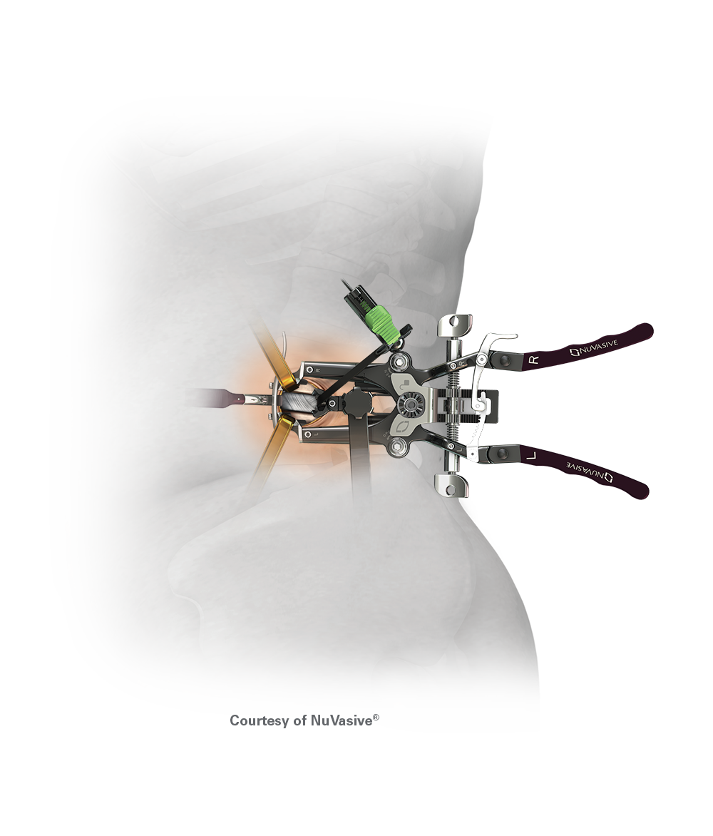 _Wirbelsäulenchirurgie, Neurochirurgie und Spezielle Orthopädie ...